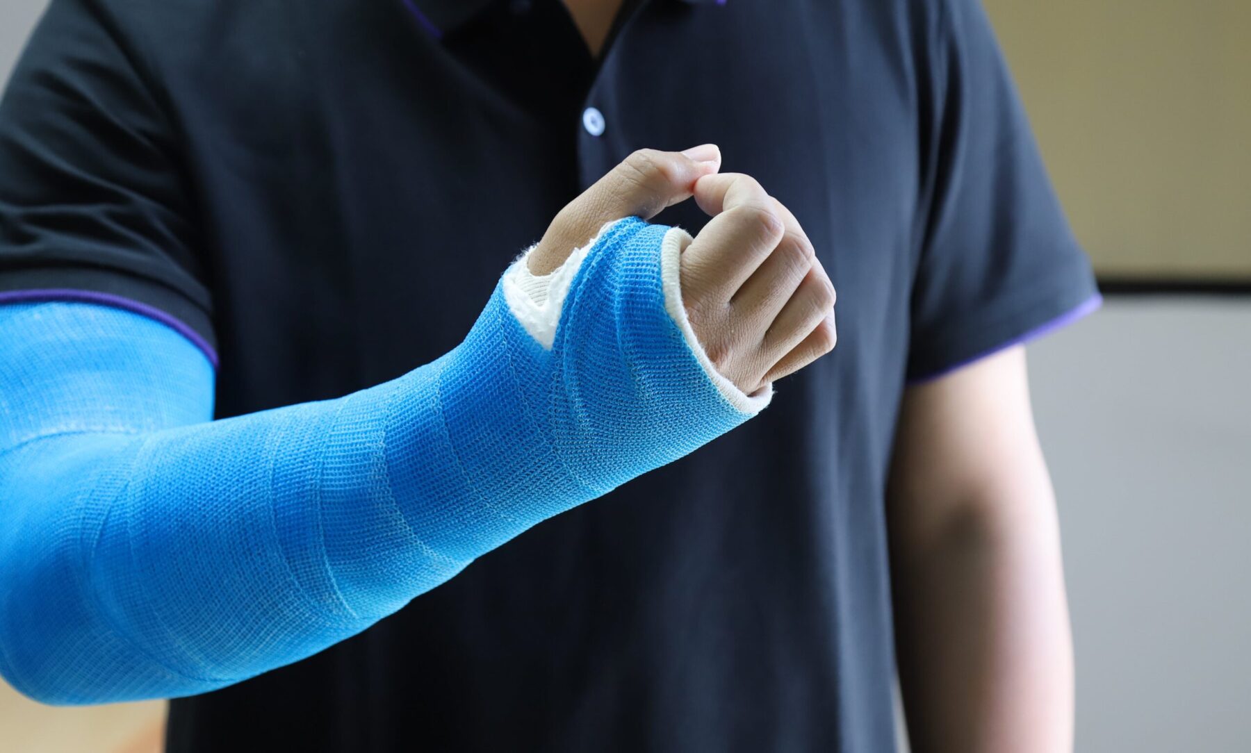 Fracture Treatment & Casting – Centre for Advanced Orthopaedics